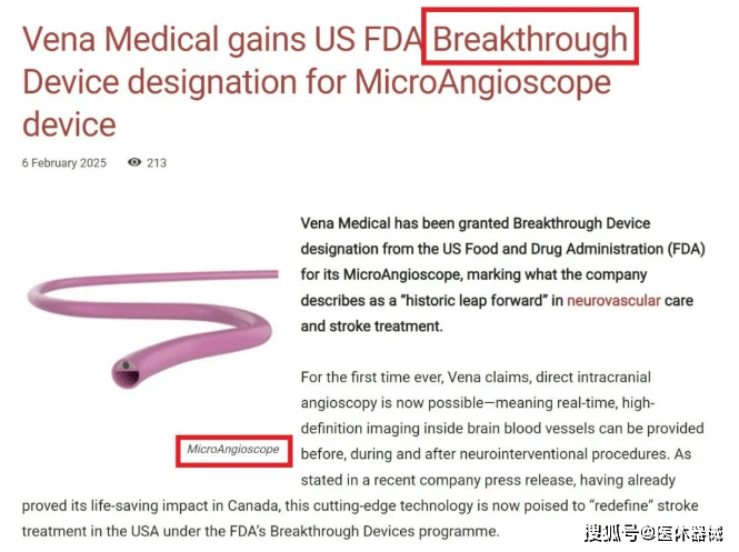 全球首款血管内镜获FDA“突破性设备”&中国过去10年创新器械盘点_导管_系统