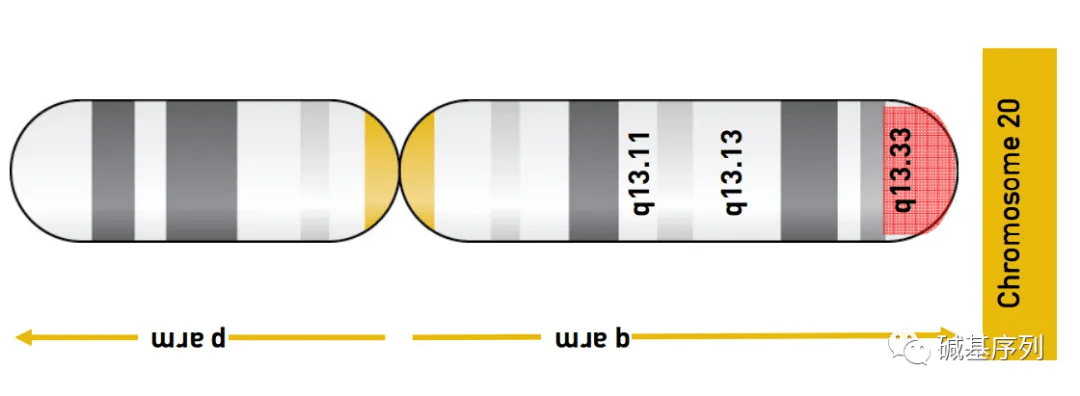 20号染色体及相关疾病_体细胞_表型_畸形