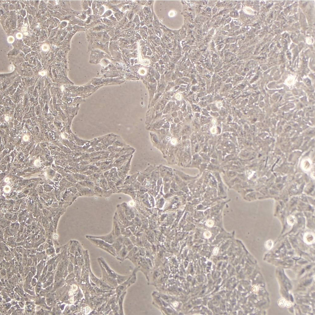 A7r5 Cells大鼠胸大动脉平滑肌细胞系带STR图谱_相关_特性_背景